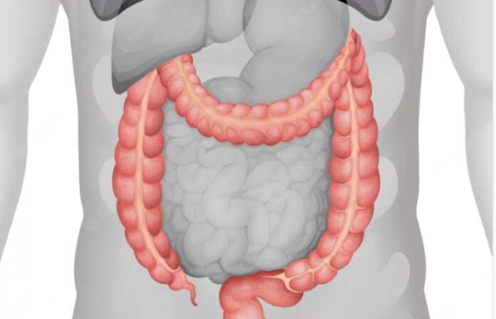 Diverticolite: ecco cosa non dovresti mai mangiare, fai molta ...
